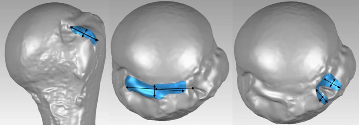 Superior Capsule Anatomy Pittsburgh PA | Dr. Schmidt