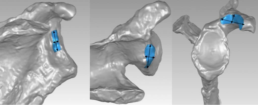 Superior Capsule Anatomy Pittsburgh PA | Dr. Schmidt